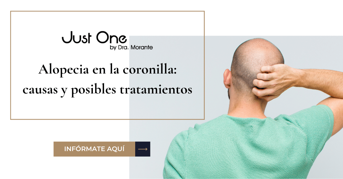 Alopecia en la coronilla: causas y posibles tratamientos