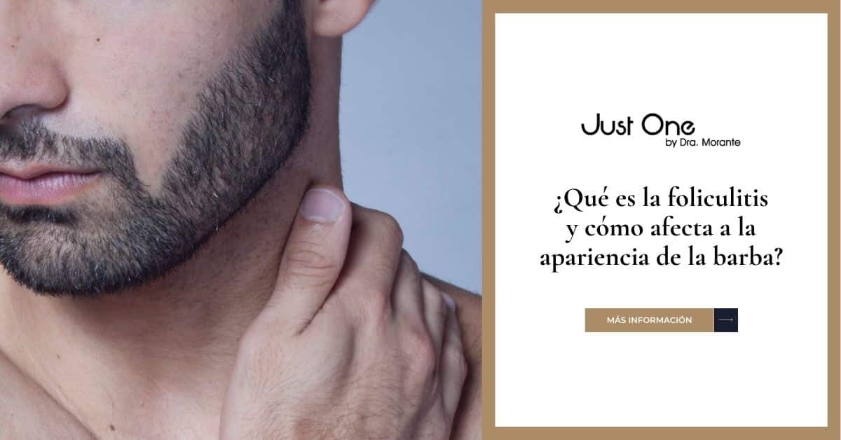 Foliculitis en la barba: qué es y tratamiento I Dra. Morante