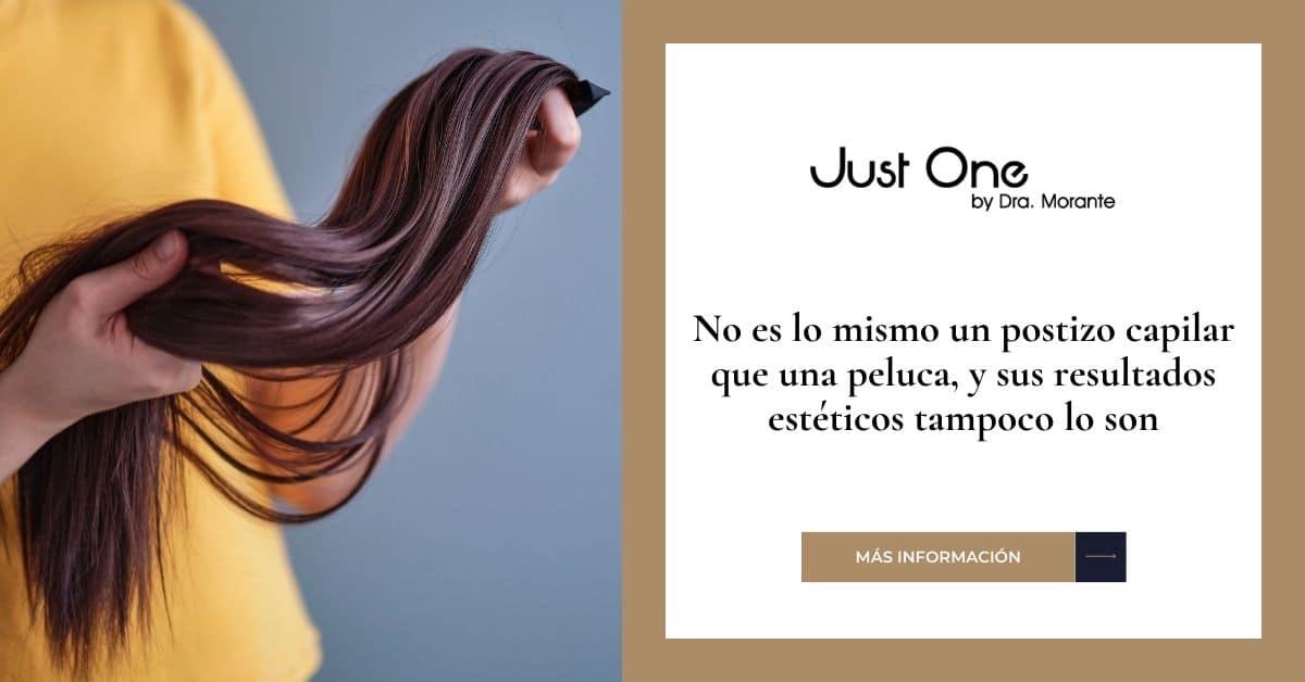 Qué son y cómo se utilizan los postizos para alopecia femenina